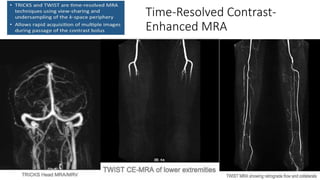 Magnetic Resonance Angiography of head and neck.pptx