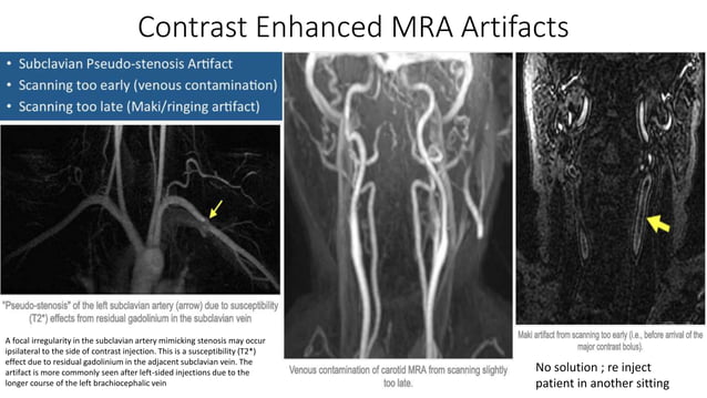 Magnetic Resonance Angiography of head and neck.pptx