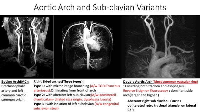 Magnetic Resonance Angiography of head and neck.pptx