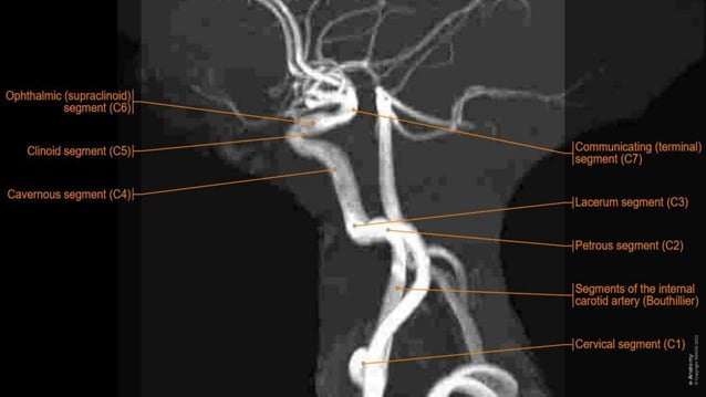 Magnetic Resonance Angiography of head and neck.pptx