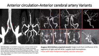 Magnetic Resonance Angiography of head and neck.pptx