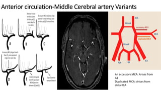 Magnetic Resonance Angiography of head and neck.pptx