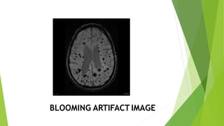 mr angiography.pptx