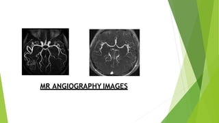 mr angiography.pptx