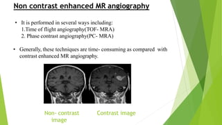 mr angiography.pptx