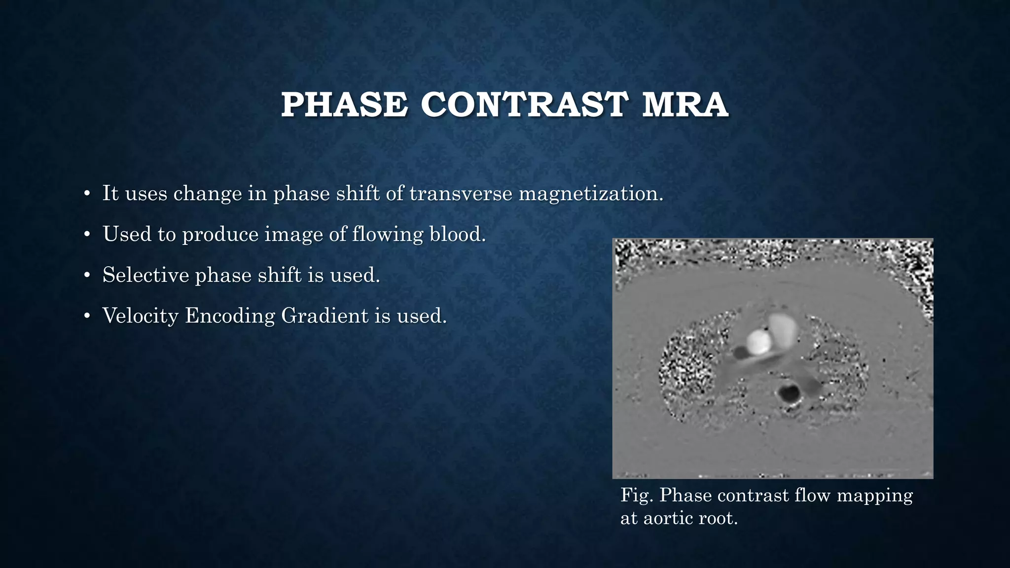 MR ANGIOGRAPHY PHYSICS | PPTX