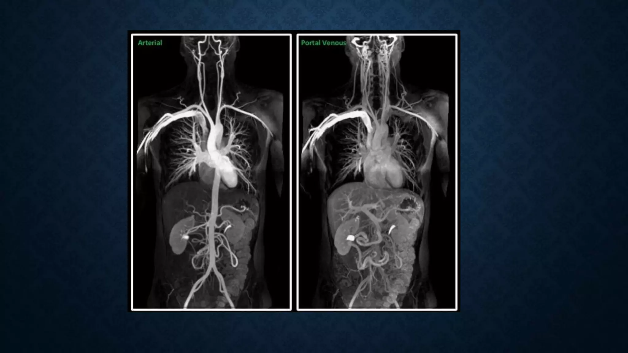 MR ANGIOGRAPHY PHYSICS | PPTX