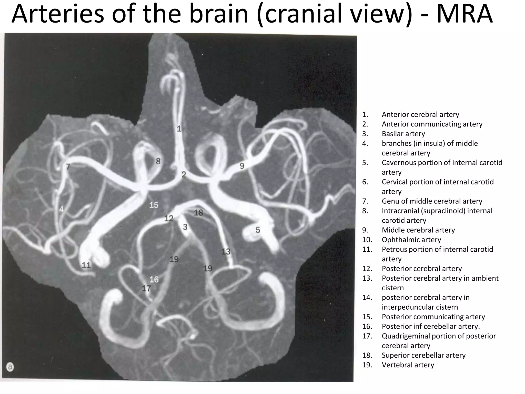magnetic resonance angiography | PPTX