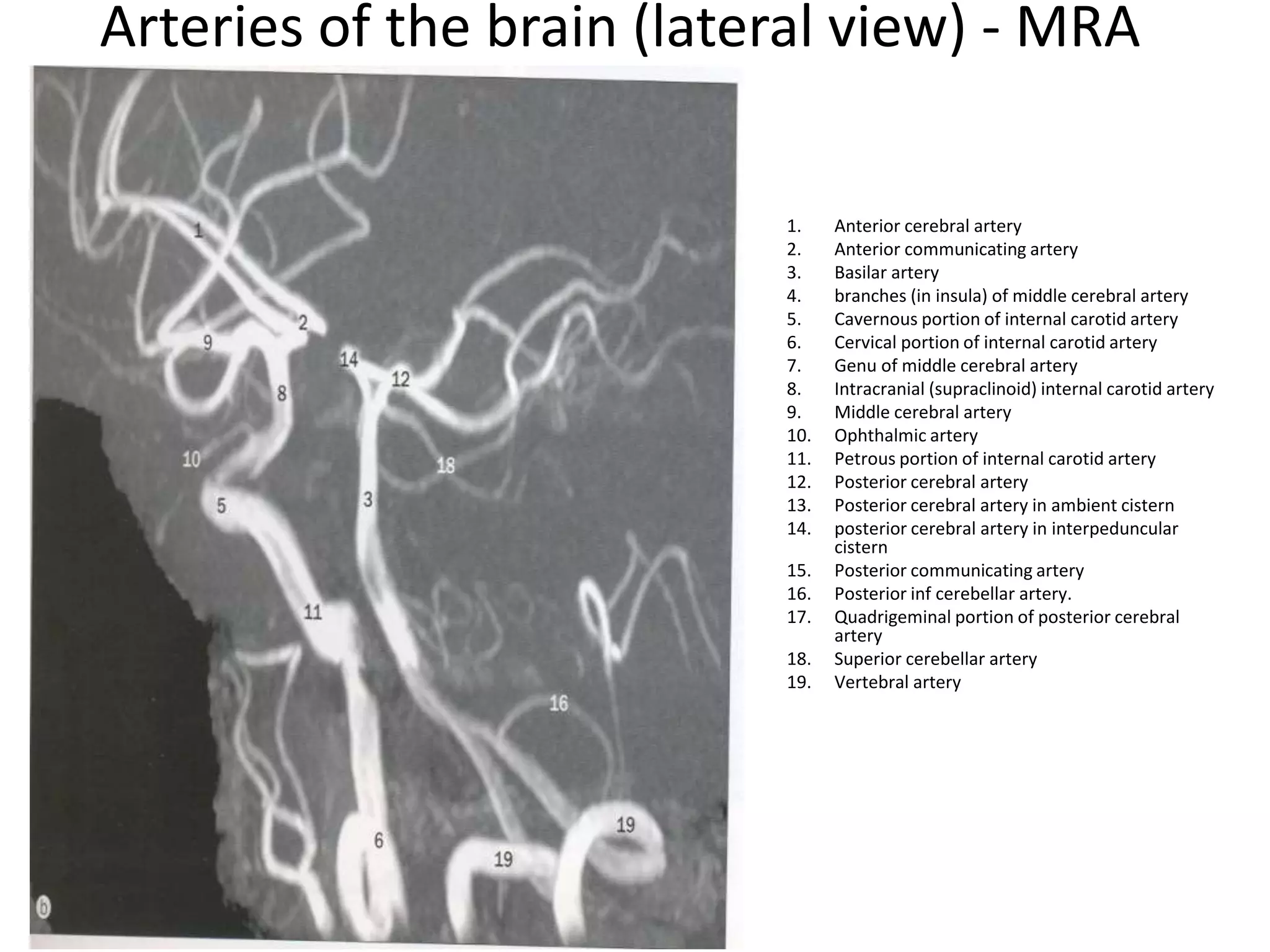 magnetic resonance angiography | PPTX