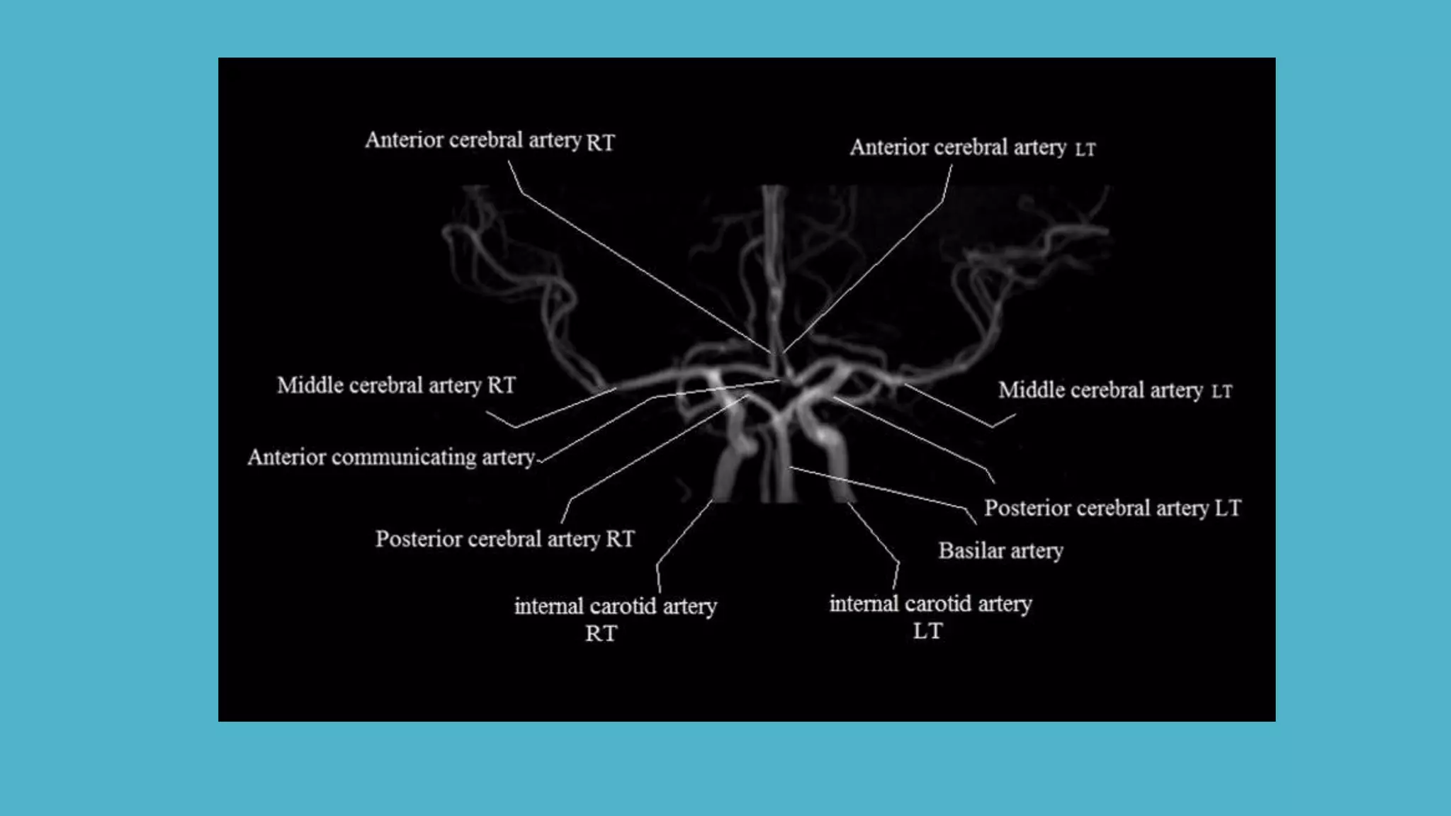 Magnetic Resonance Angiography and Venography | PPTX