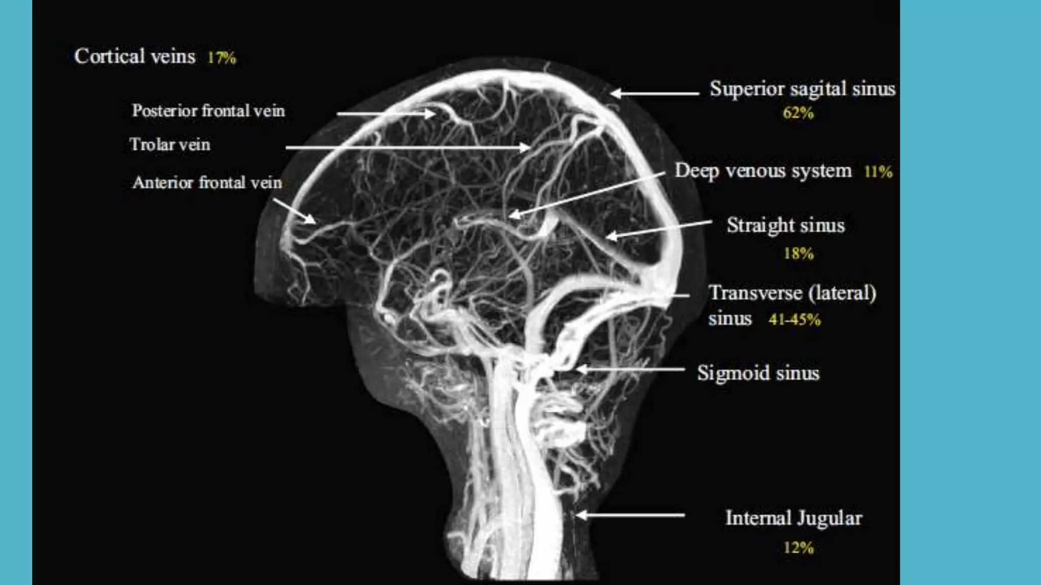 Magnetic Resonance Angiography and Venography | PPTX