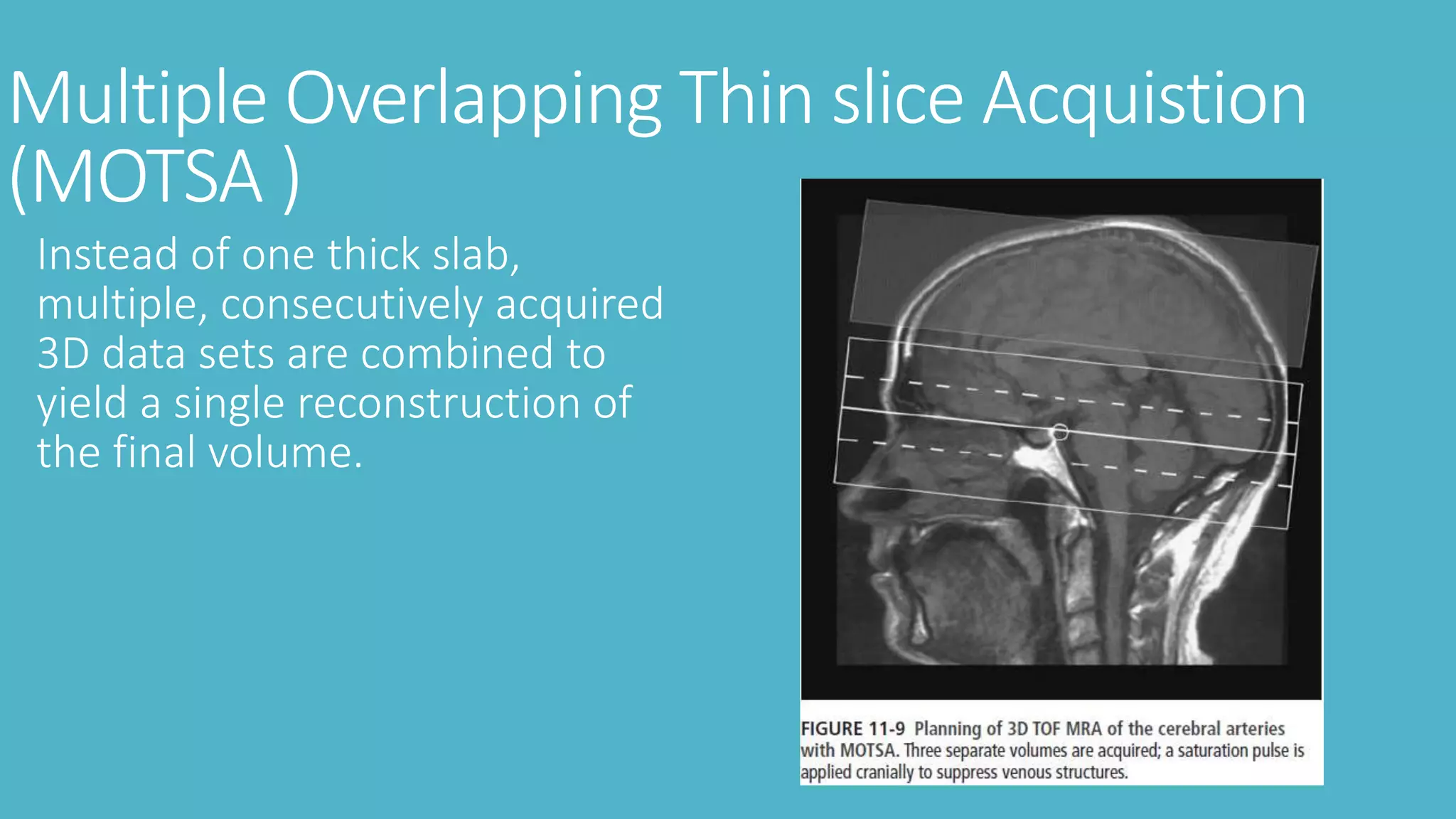 Magnetic Resonance Angiography and Venography | PPTX