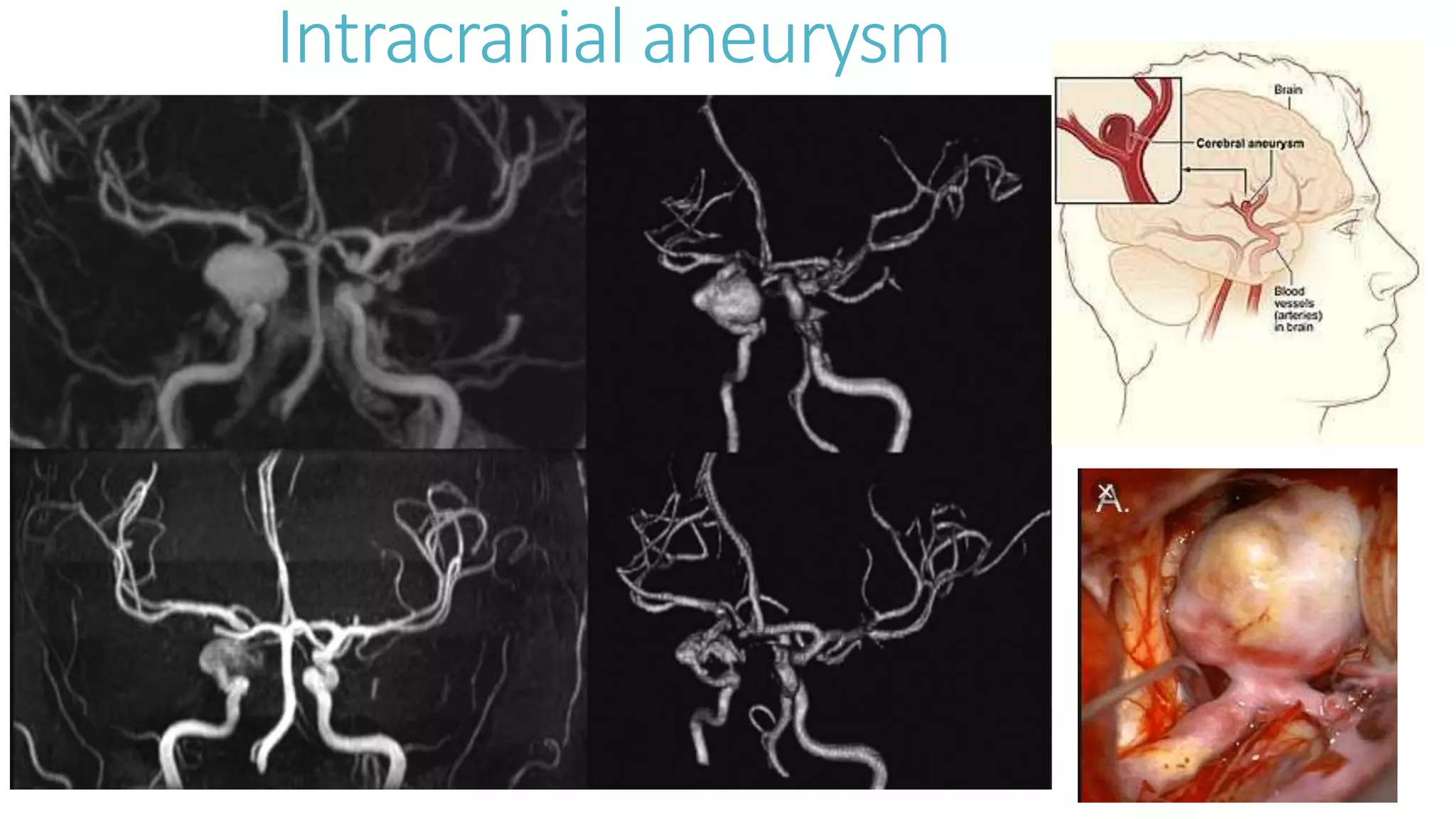 Magnetic Resonance Angiography and Venography | PPTX
