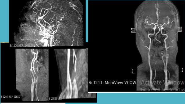 Magnetic Resonance Angiography and Venography | PPTX