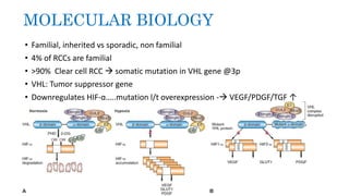 mRCC presentation.pptx