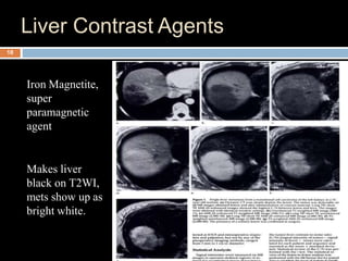 MRI contrast RADIOLOGY | PPTX