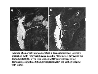 MRCP.pptx