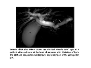 MRCP.pptx