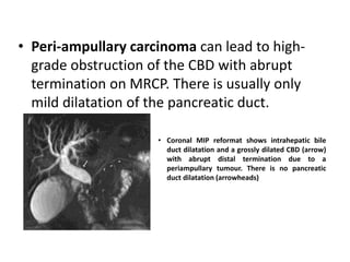 MRCP.pptx