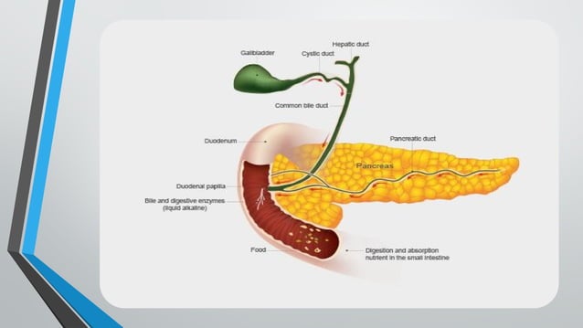 MRCP (Magnetic resonance cholangiopancreatography) | PPT