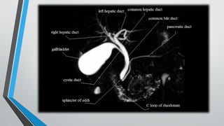 MRCP (Magnetic resonance cholangiopancreatography) | PPTX