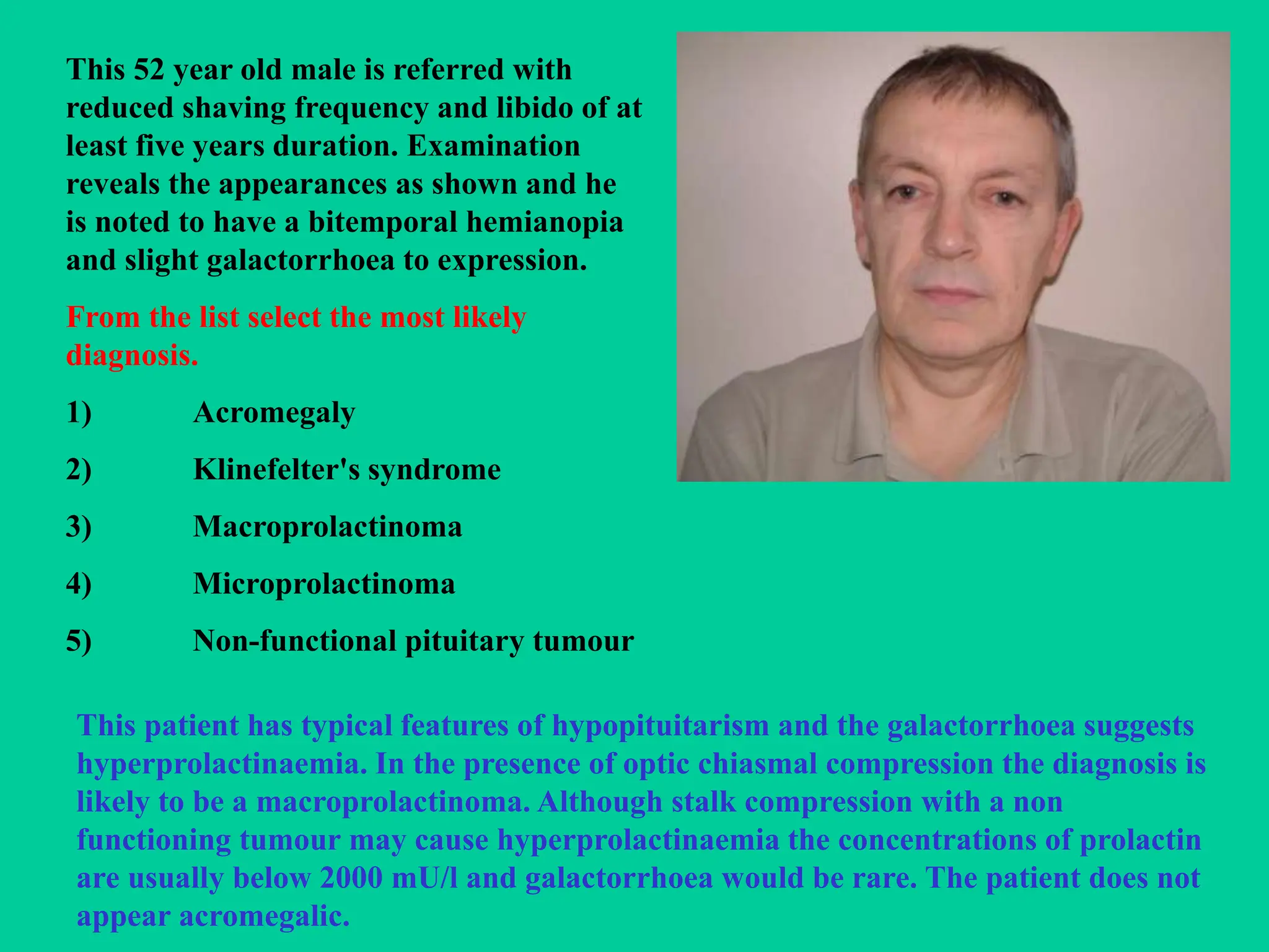 MRCP 2 - Pictures.ppt for osce examination board revi3 | PPT ...