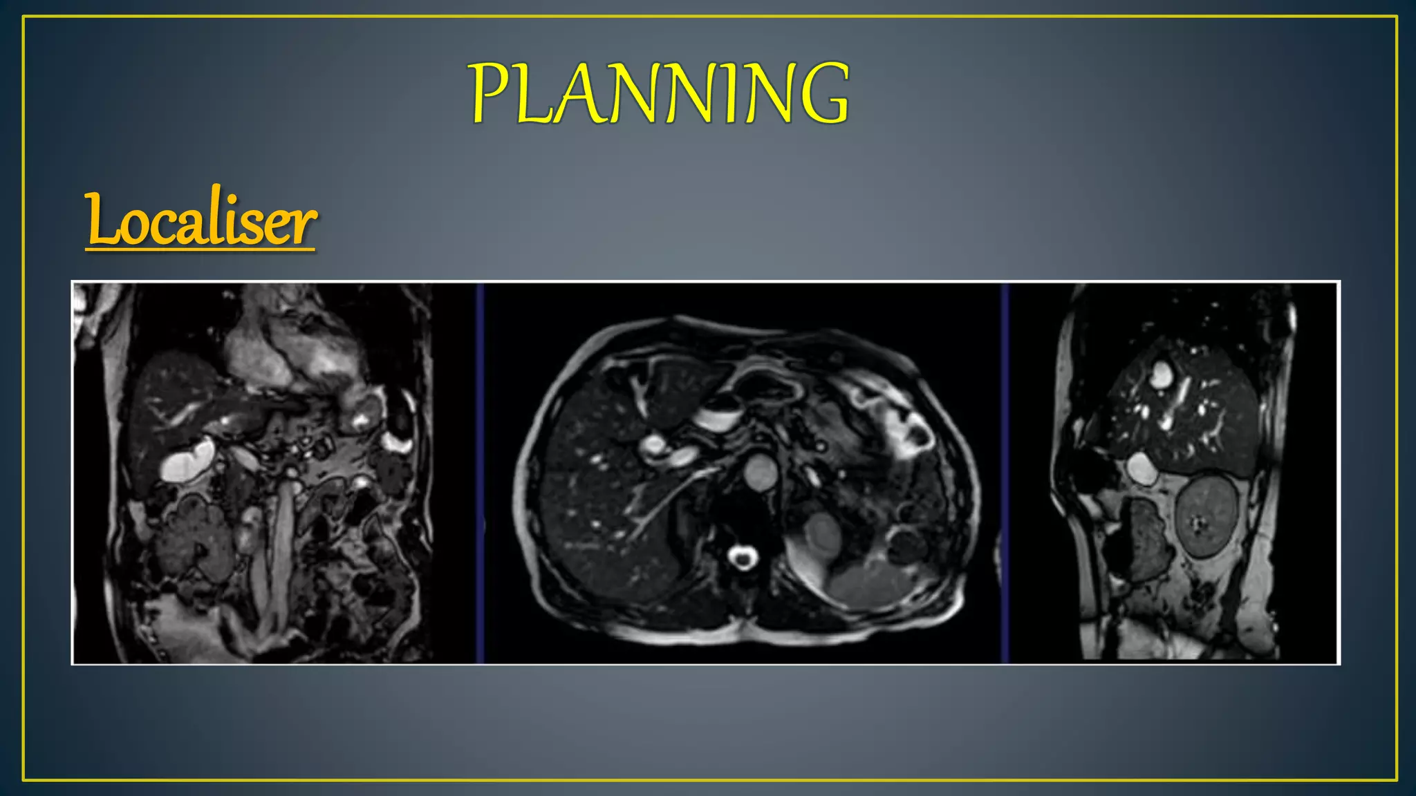 MRCP Magnetic Resonance cholangiopancreatography | PPTX | Lung and Respiratory Health | Diseases ...