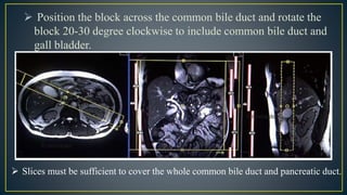 MRCP Magnetic Resonance cholangiopancreatography | PPTX