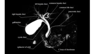 Magnetic Resonance Cholangiopancreatography- MRCP | PPTX