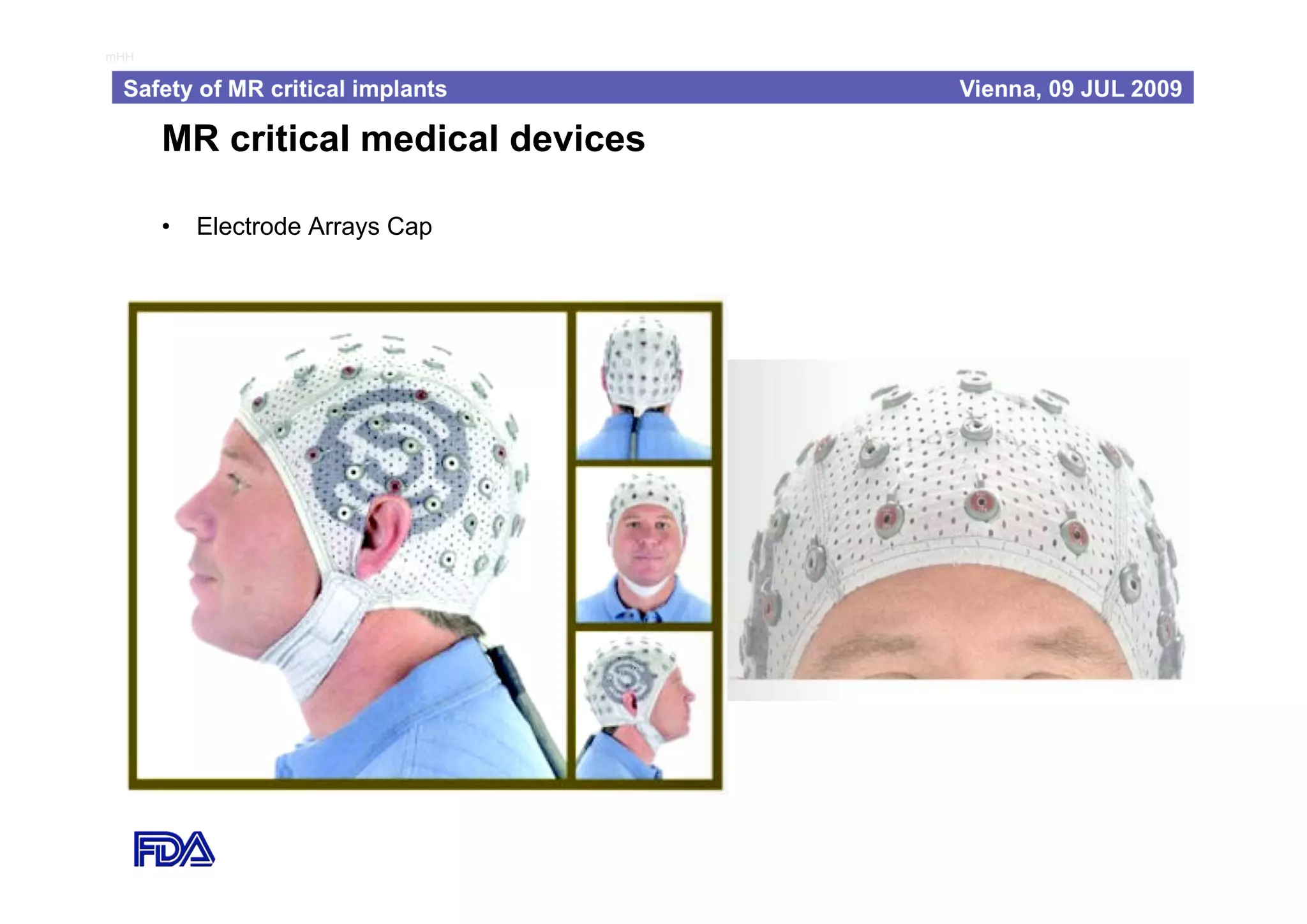 Safety of MRI Critical Medical Devices | PDF