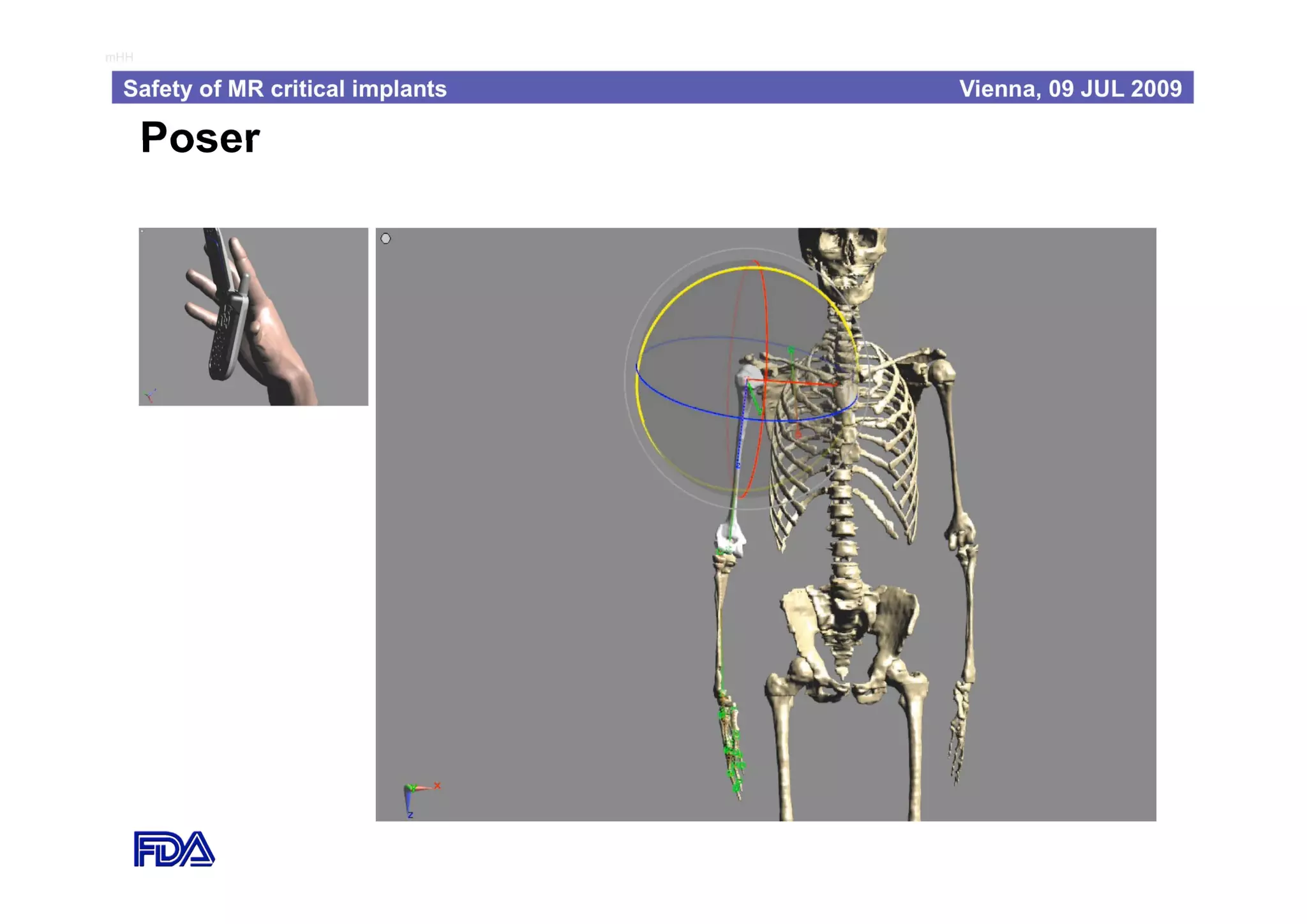 Safety of MRI Critical Medical Devices | PDF