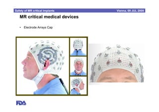 Safety of MRI Critical Medical Devices | PDF