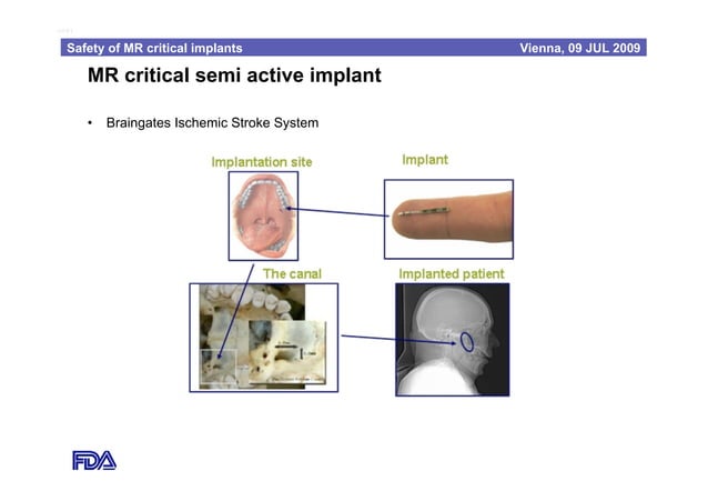 Safety of MRI Critical Medical Devices | PDF | Healthcare Industry ...