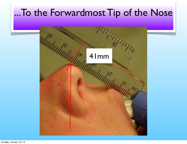 How recessed are you? How to track progress inside – Main Forum ...