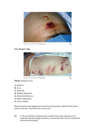 MRCS preparation eMrcs questions surgery | PDF