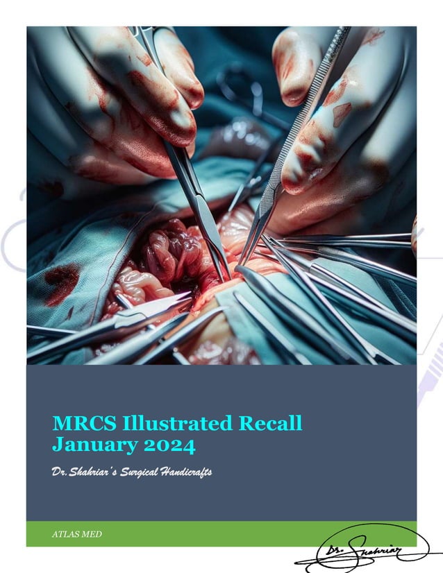 MRCS Recall January 2024 @ Dr.Shahriars Surgical Handicrafts | PDF | Thyroid Disorders ...