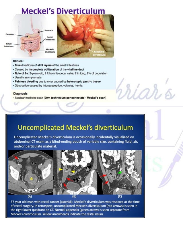 MRCS Recall January 2024 @ Dr.Shahriars Surgical Handicrafts | PDF | Thyroid Disorders ...