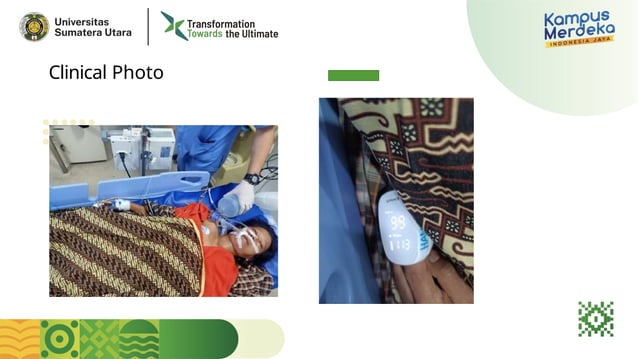 Kasus pemasangan CVC di rumah sakit adam | PPTX | Lung and Respiratory ...
