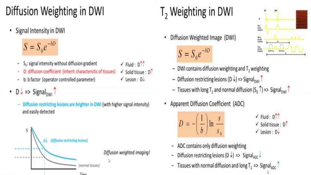 MR DIFFUSION PERFUSION & ARTIFACTS.pptx | Free Download