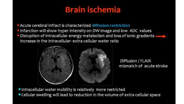 MR DIFFUSION PERFUSION & ARTIFACTS.pptx | Free Download
