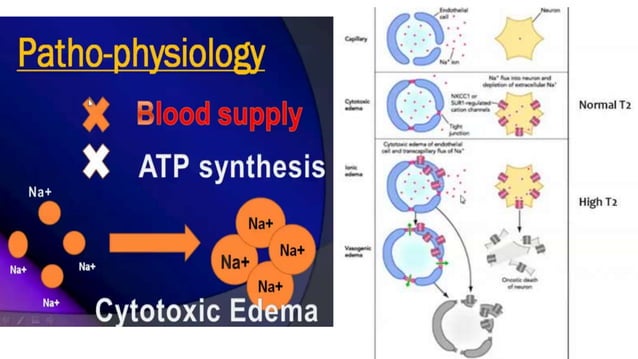 MR DIFFUSION PERFUSION & ARTIFACTS.pptx | Free Download