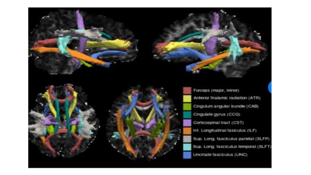 MR DIFFUSION PERFUSION & ARTIFACTS.pptx | Free Download
