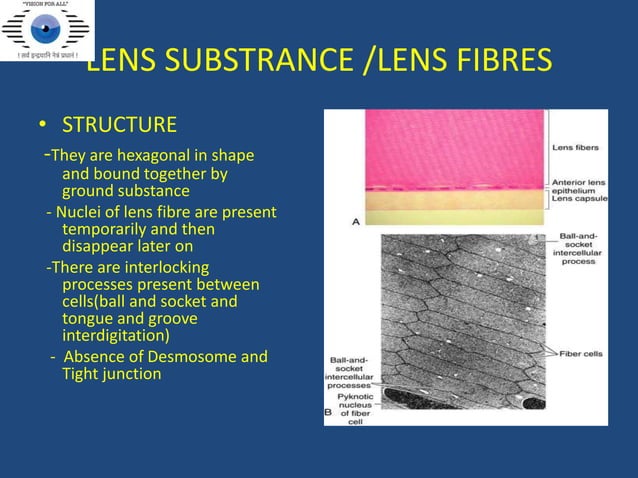 ANATOMY_OF_LENS presentation dhir hospital.pptx