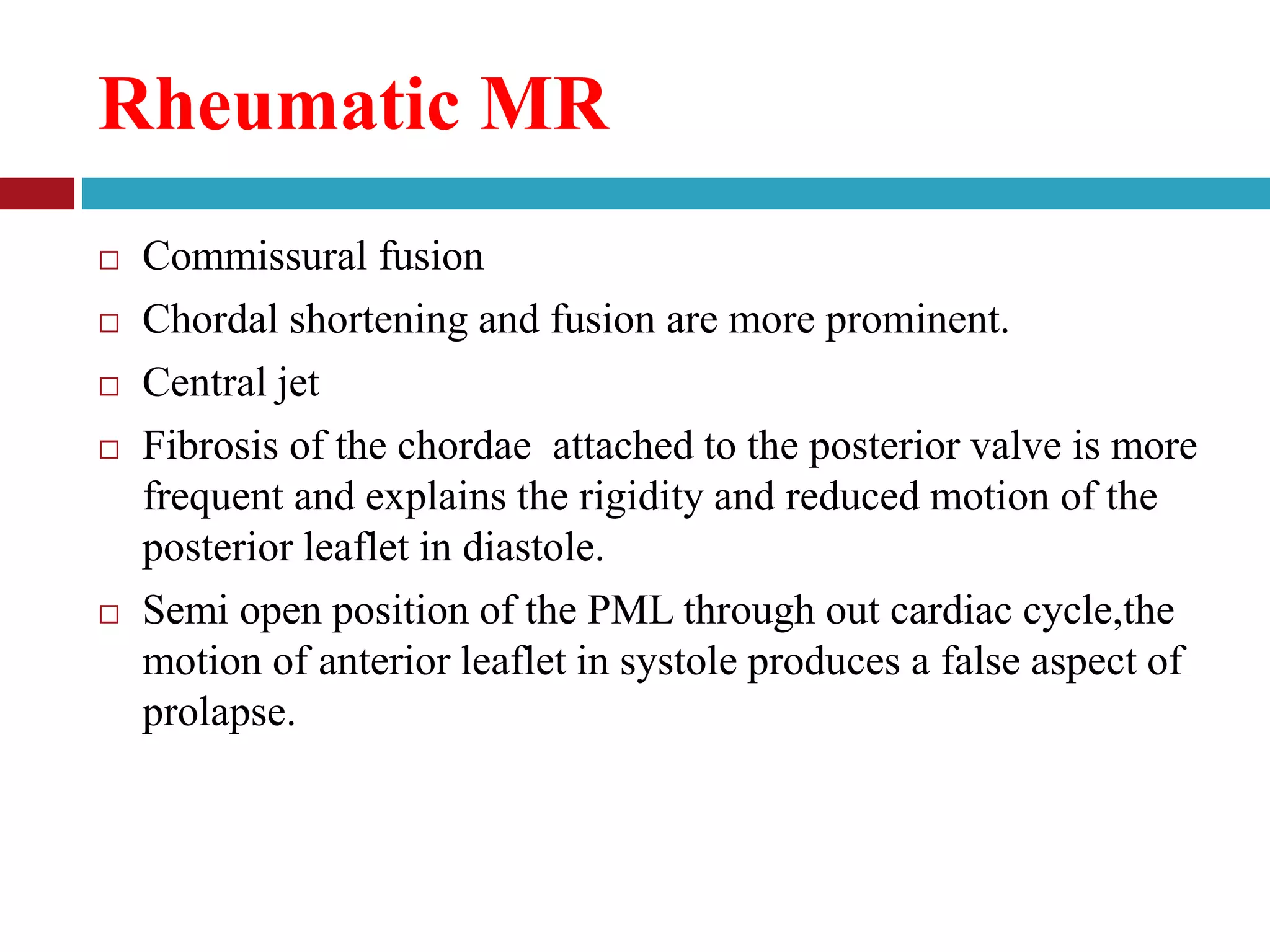 ECHOCARDIOGRAPHIC EVALUATION OF MITRAL VALVE DISEASE -MITRAL ...
