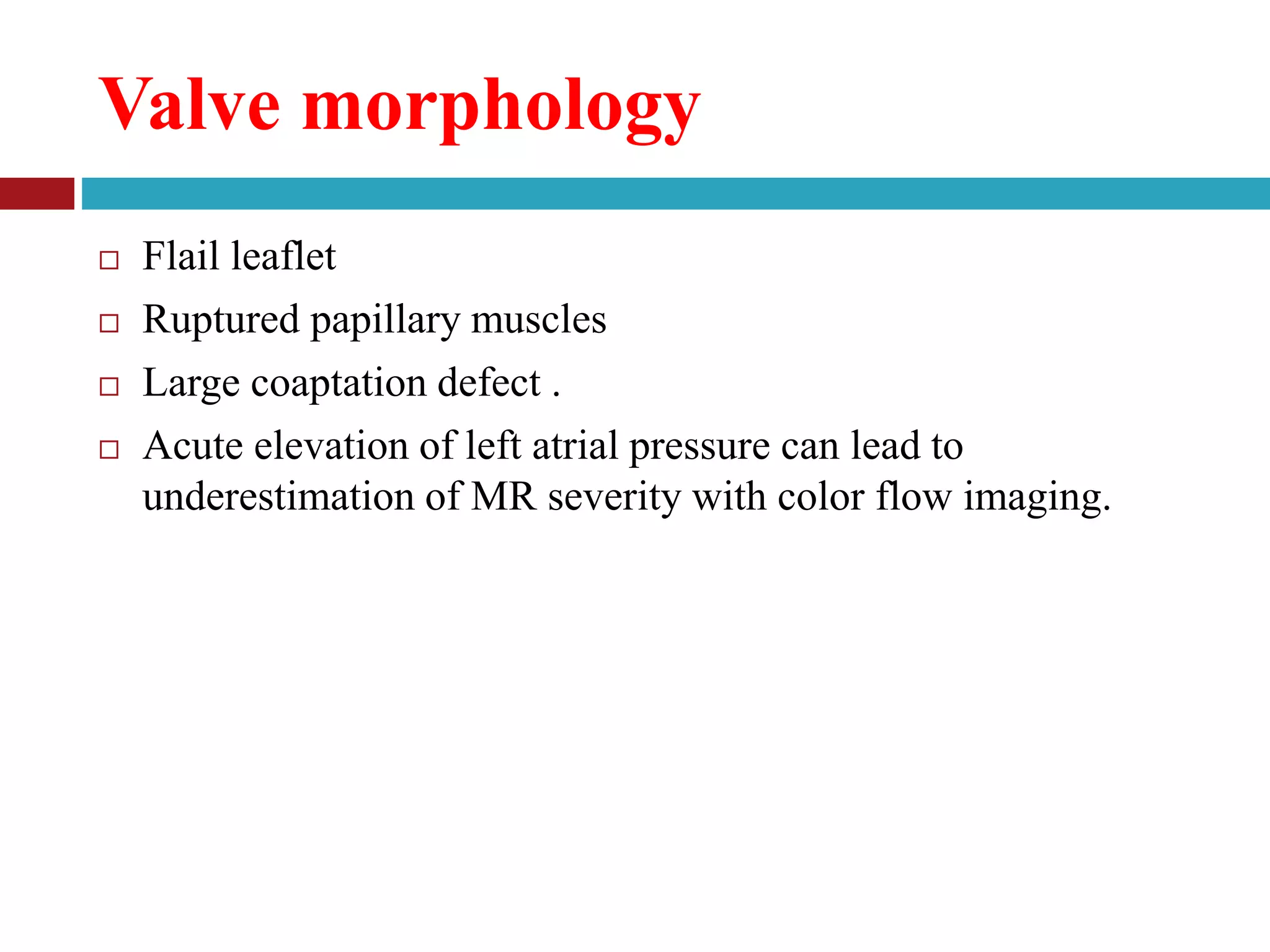 ECHOCARDIOGRAPHIC EVALUATION OF MITRAL VALVE DISEASE -MITRAL ...