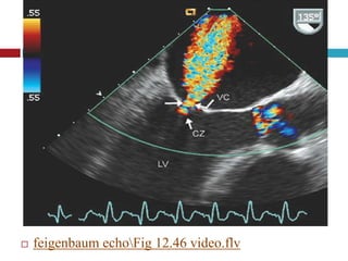 ECHOCARDIOGRAPHIC EVALUATION OF MITRAL VALVE DISEASE -MITRAL ...