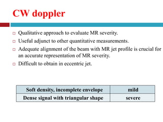 ECHOCARDIOGRAPHIC EVALUATION OF MITRAL VALVE DISEASE -MITRAL ...
