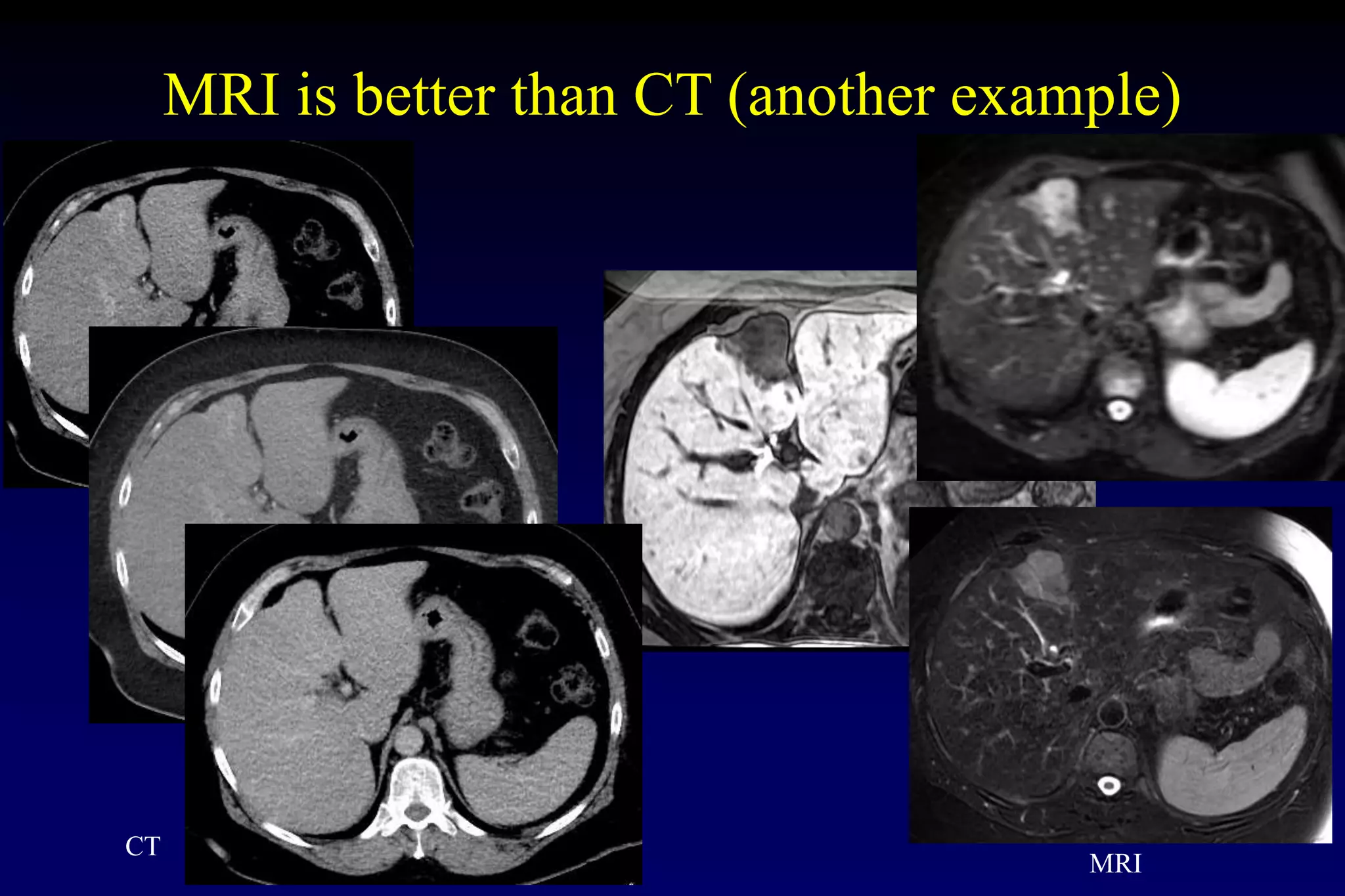 Radiology Basics | PPTX