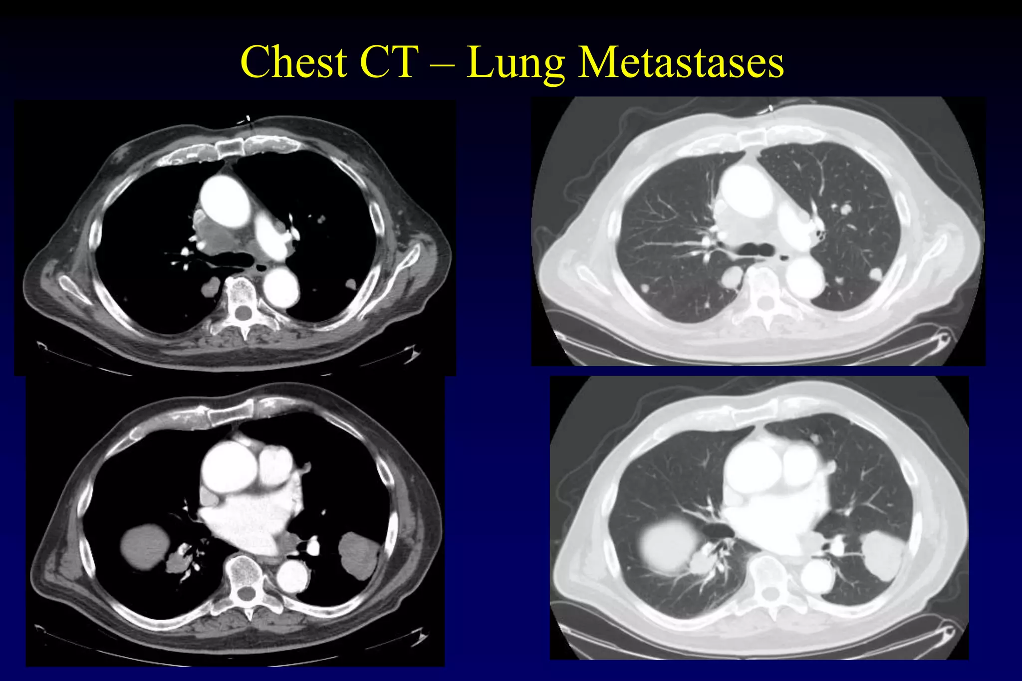 Radiology Basics | PPTX