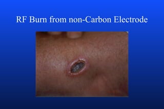 Mr hazard protection | PPT